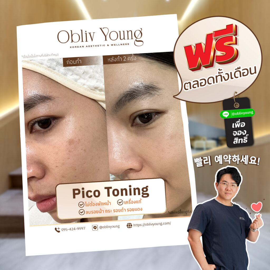 FREE PICO Laser Bangkok | Acne Scar & Pigmentation Removal